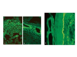 COMMON DISEASES OF THE SKIN.pptx | Skin and Dermatology | Diseases and ...