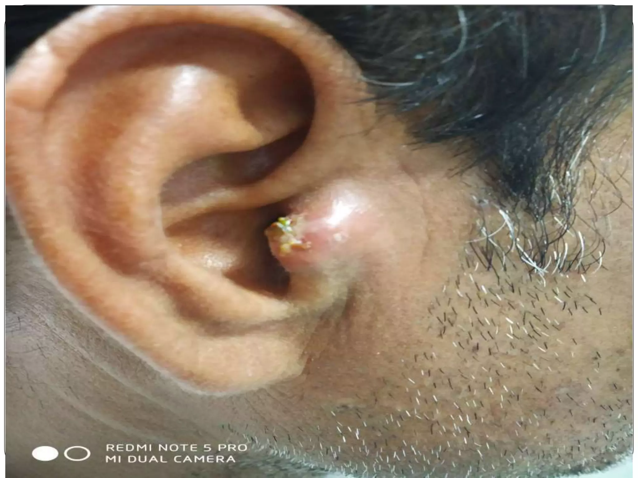 Types Of Common Ear Diseases. | PPT