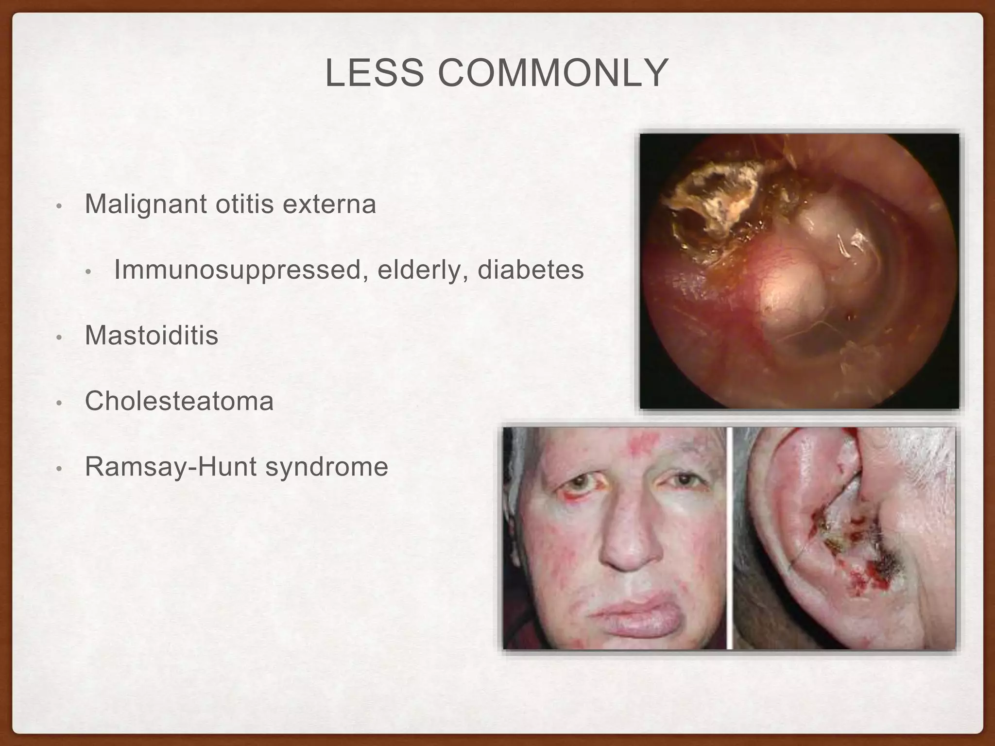 Common ear disorders | PPTX