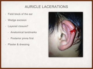 Common ear disorders | PPTX