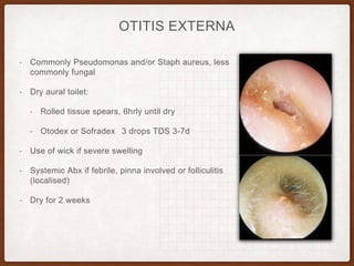 Common ear disorders | PPTX