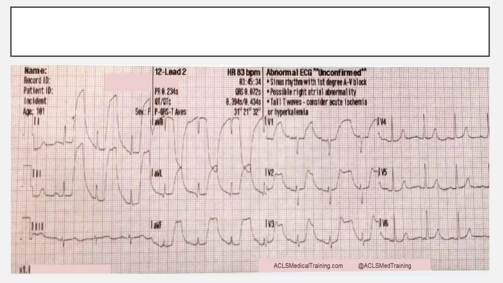 ECGs in clinical practice.pptx