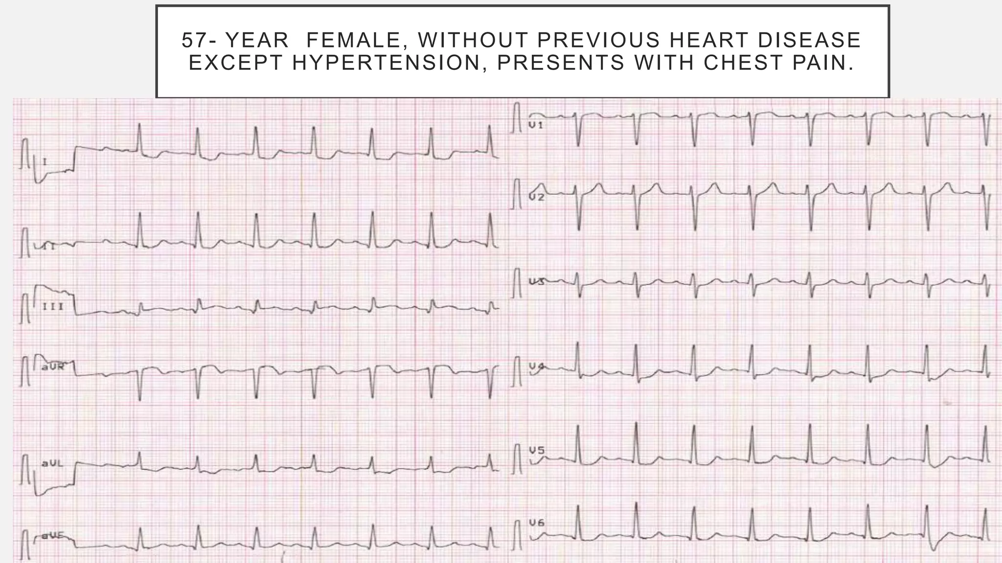 ECGs in clinical practice.pptx