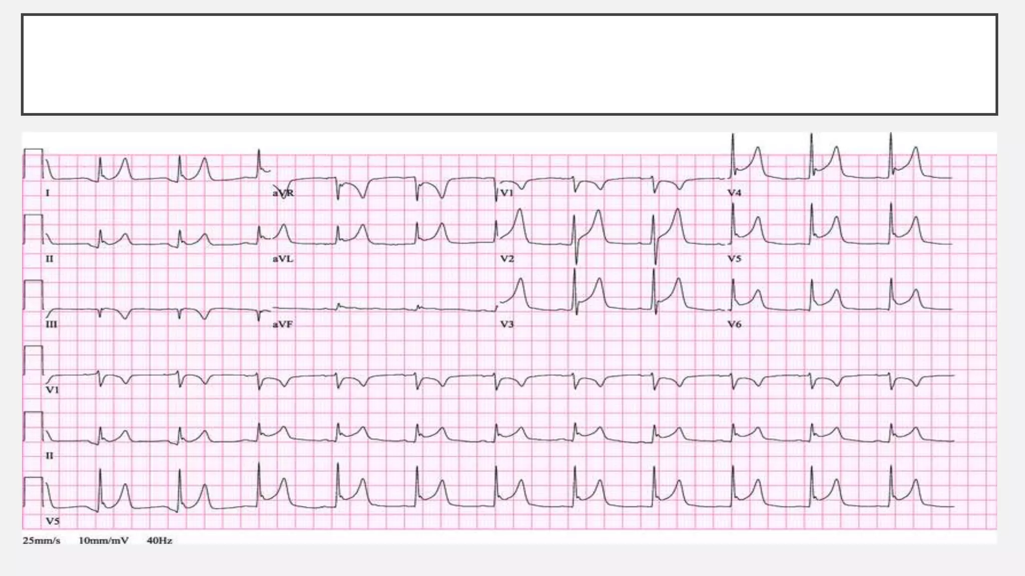 ECGs in clinical practice.pptx