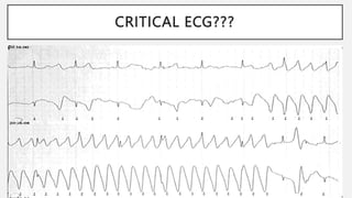 ECGs in clinical practice.pptx