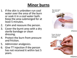 Common emergencies | PPT