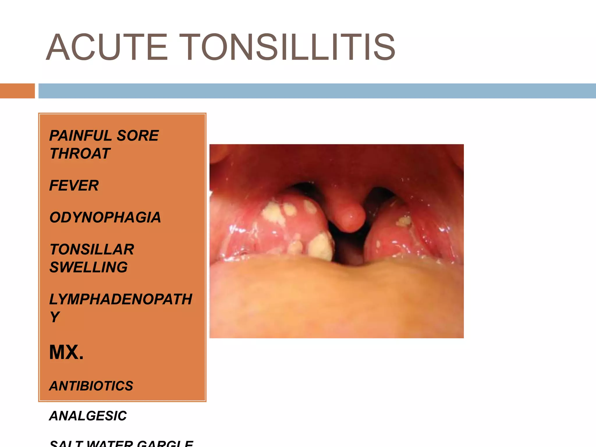 Common ent disorders | PPTX