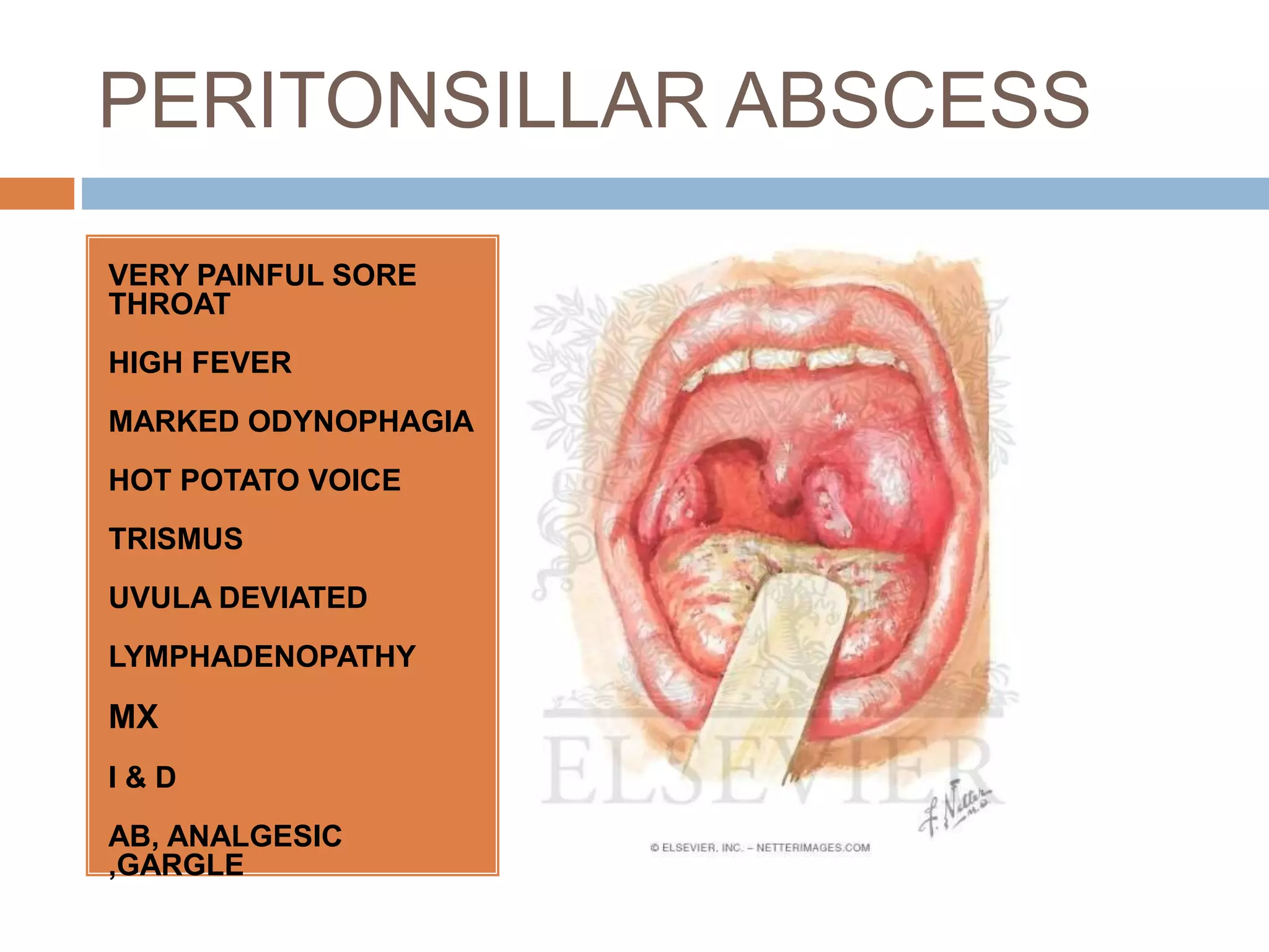 Common ent disorders | PPTX