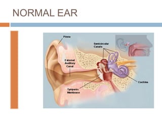 Common ent disorders | PPTX