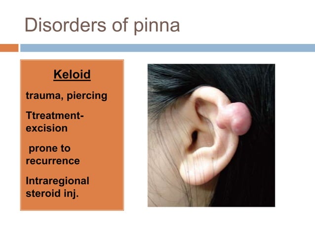 Common ent disorders | PPTX