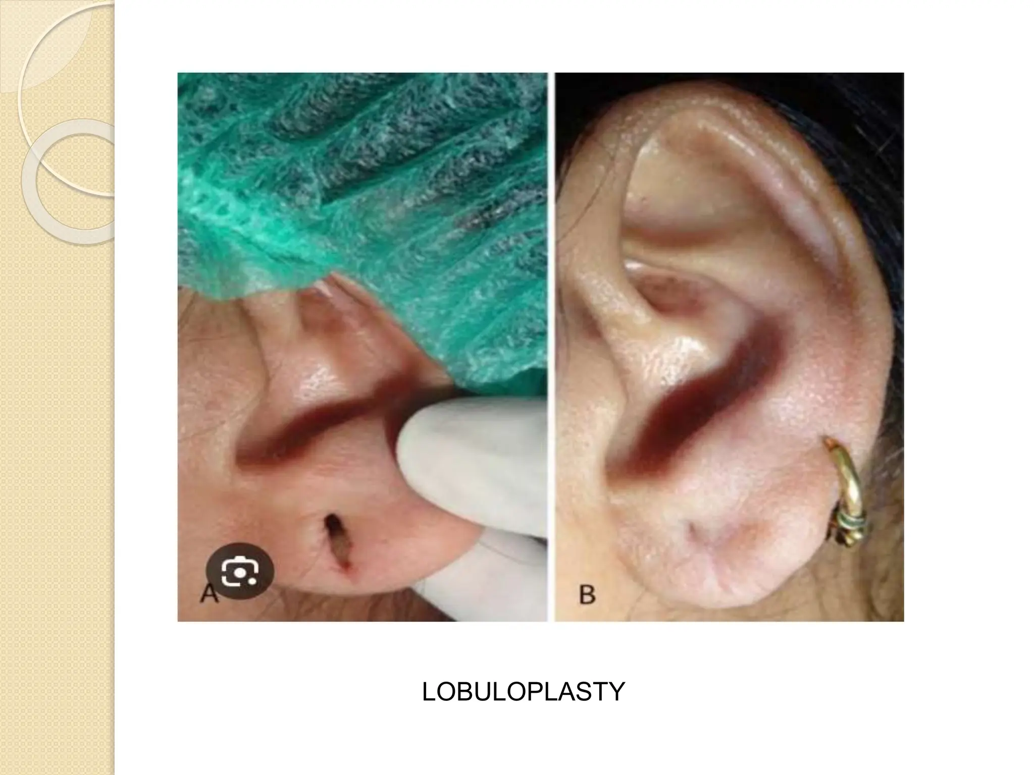 common ear nose throat PROBLEMS seen in opd | PPTX
