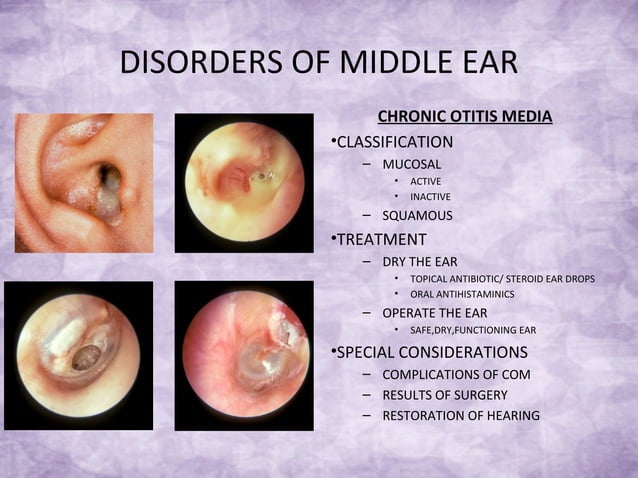 Common ent problems and managements | PPT | Ear, Nose and Throat ...