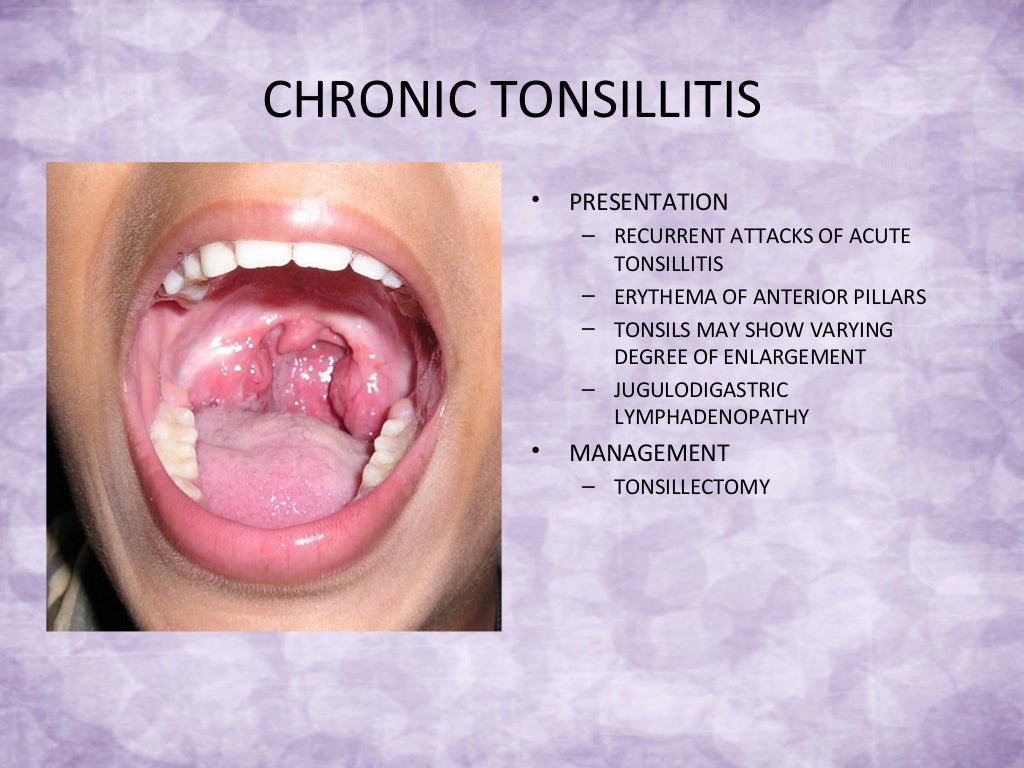 Common ent problems and managements