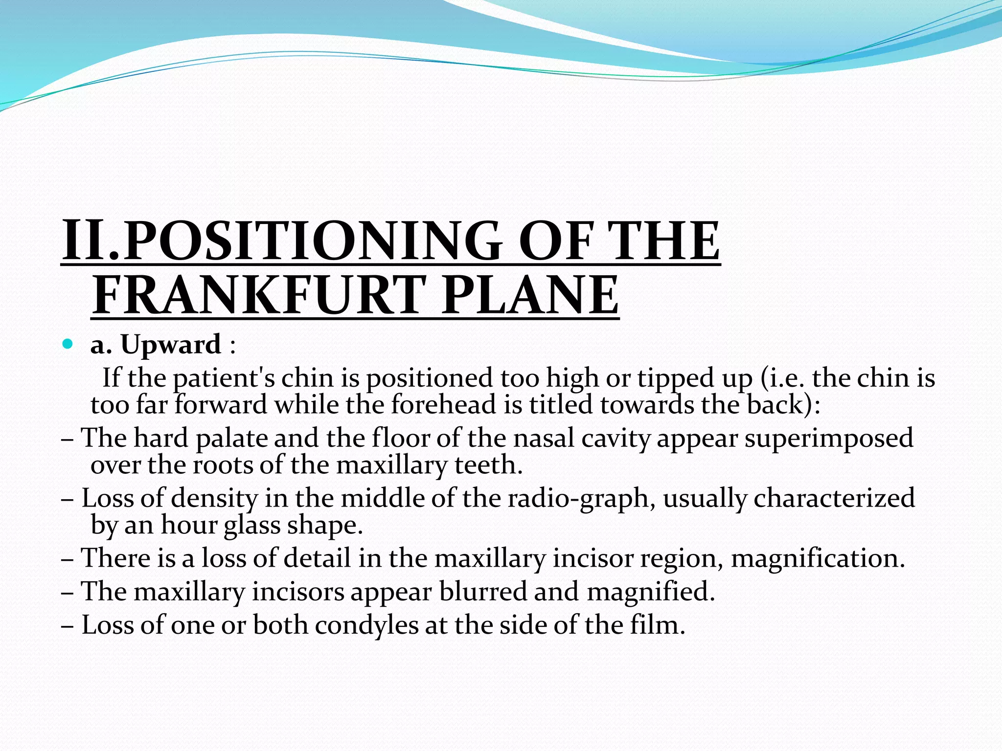 Common errors in opg | PPTX