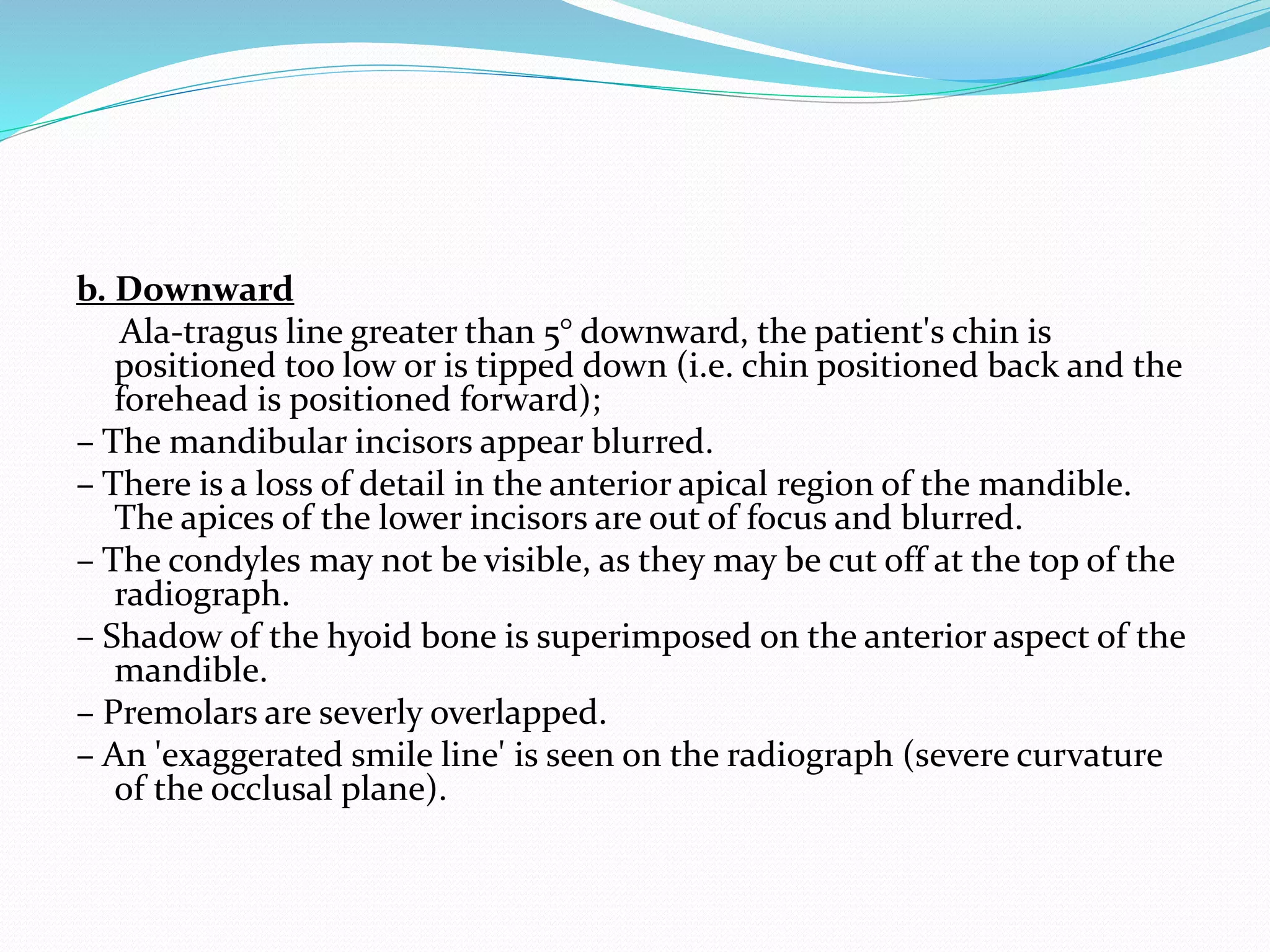 Common errors in opg | PPTX