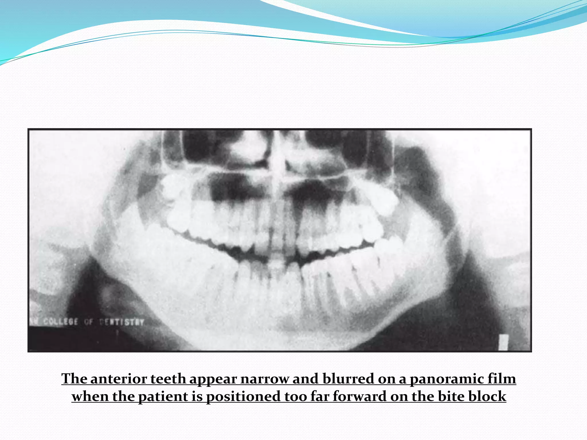 Common errors in opg | PPTX