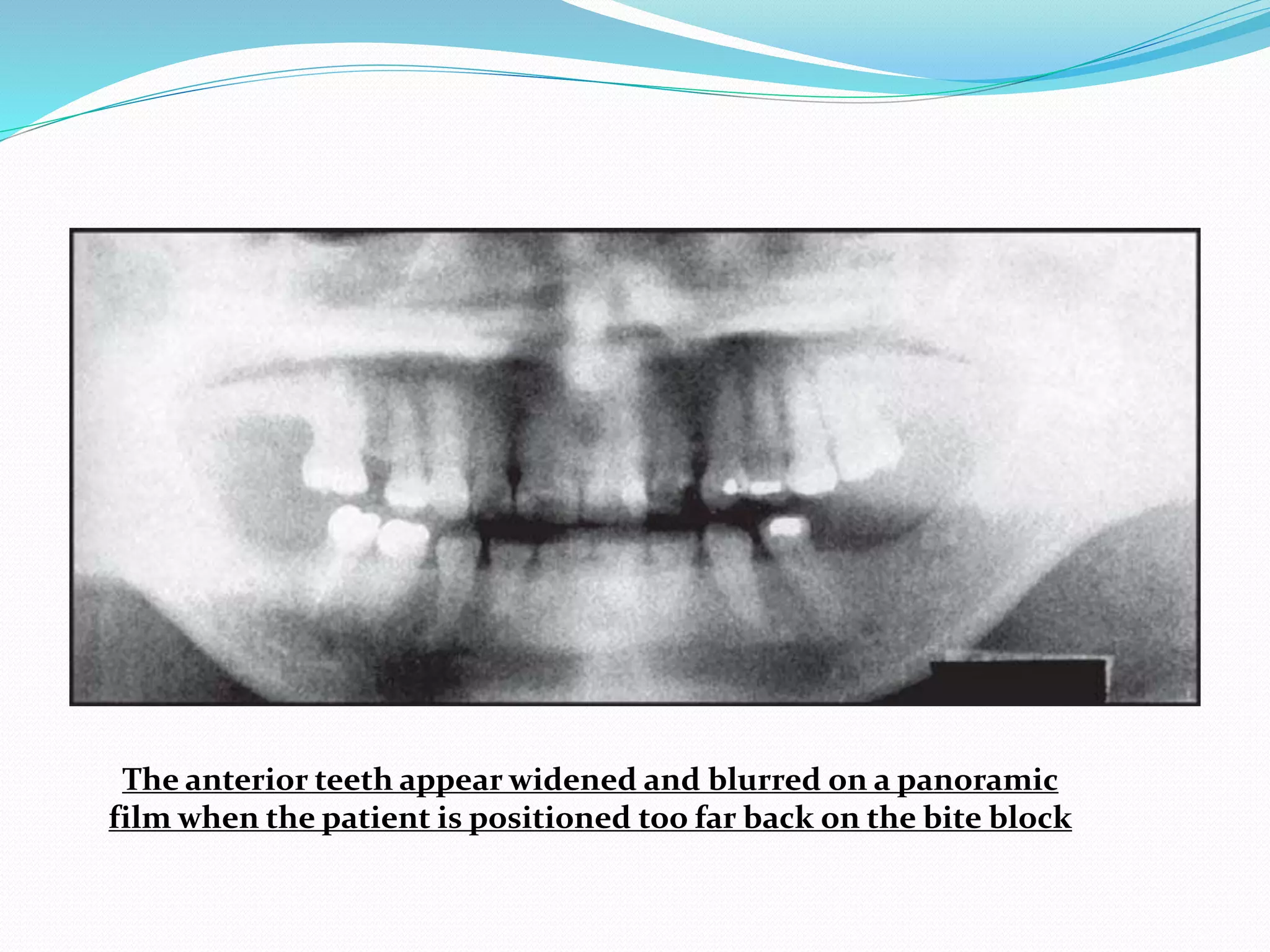 Common errors in opg | PPTX