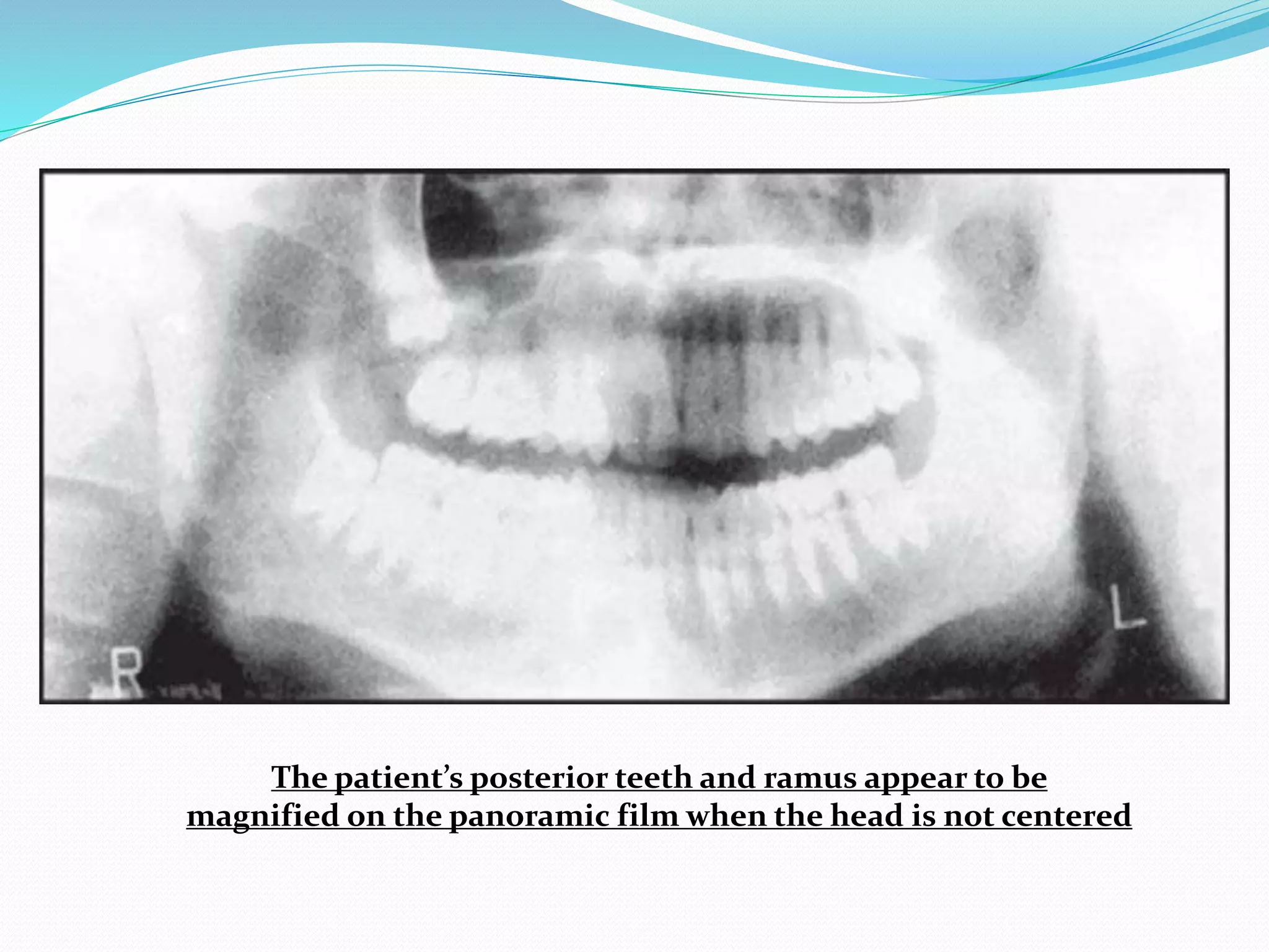 Common errors in opg | PPTX