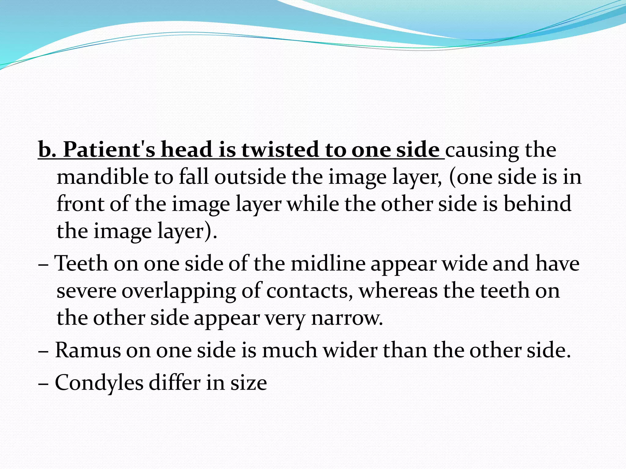 Common errors in opg | PPTX