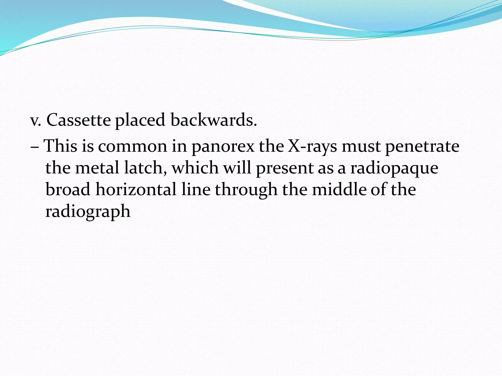 Common errors in opg | PPTX