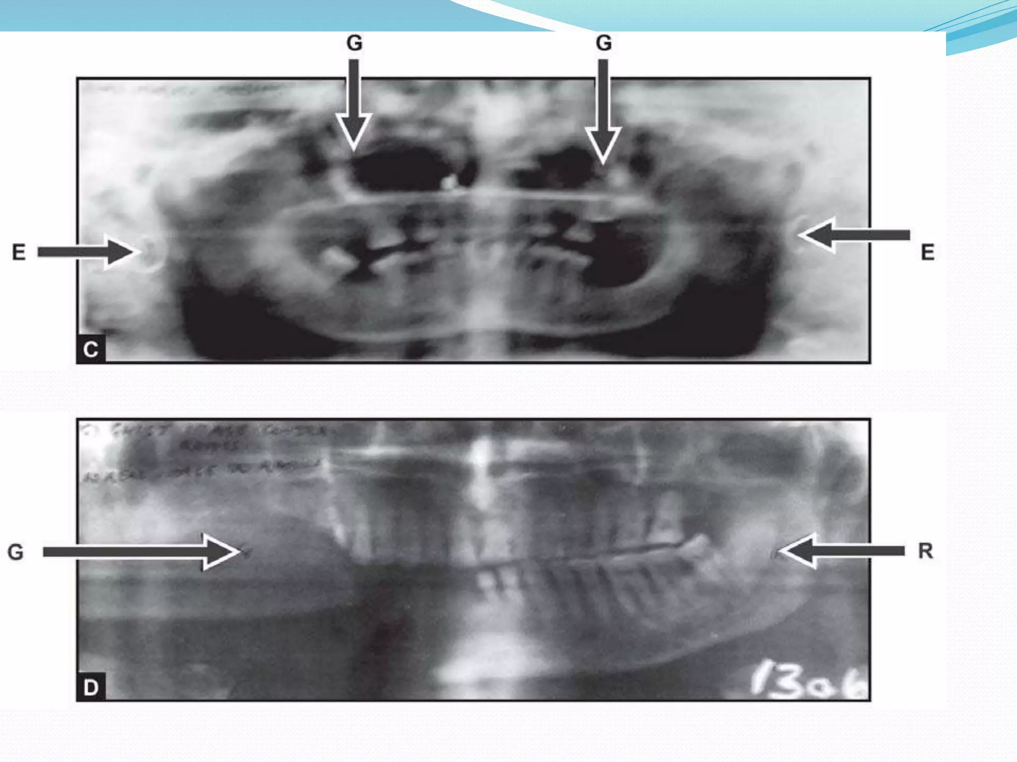 Common errors in opg | PPTX