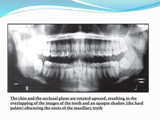 Common errors in opg | PPTX