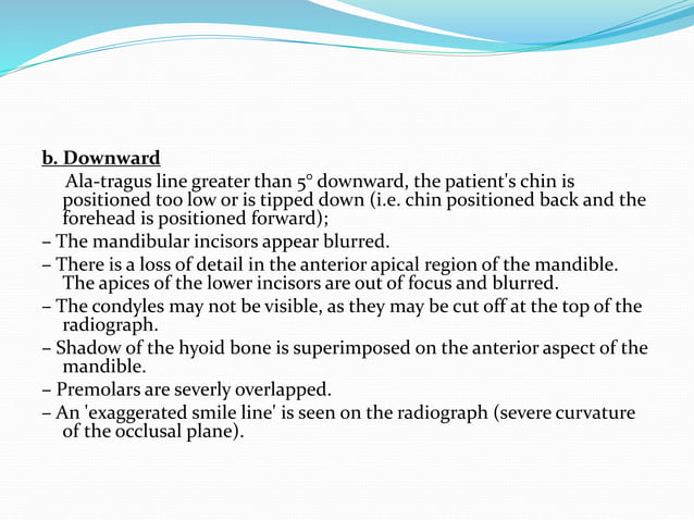 Common errors in opg | PPTX | Dental Health | Diseases and Conditions