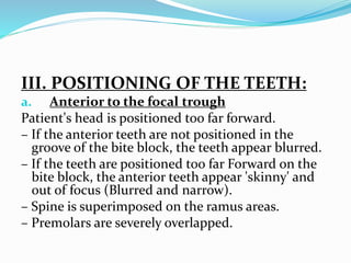 Common errors in opg | PPTX
