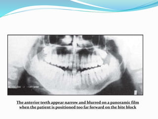 Common errors in opg | PPTX