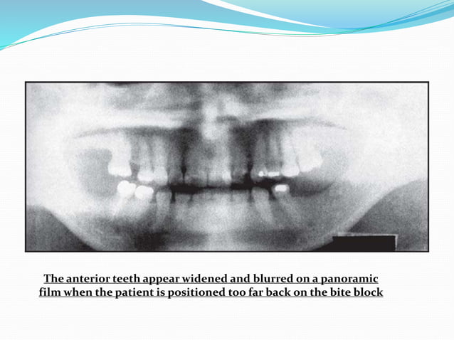 Common errors in opg | PPTX | Dental Health | Diseases and Conditions