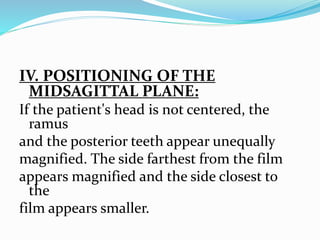 Common errors in opg | PPTX