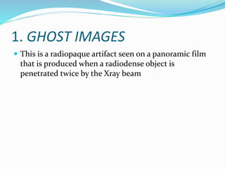 Common errors in opg | PPTX