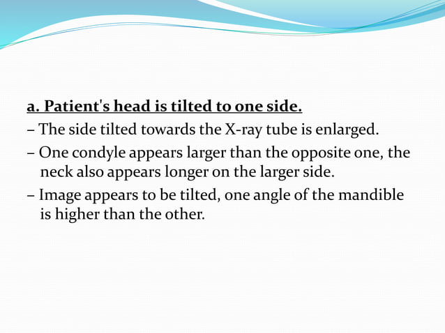 Common errors in opg | PPTX | Dental Health | Diseases and Conditions