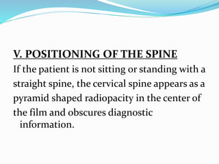 Common errors in opg | PPTX