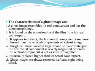 Common errors in opg | PPTX