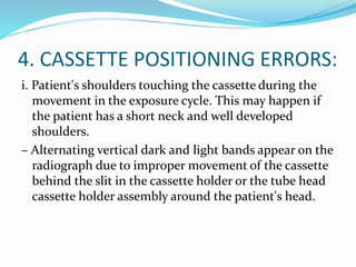 Common errors in opg | PPTX