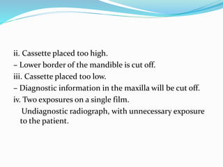 Common errors in opg | PPTX
