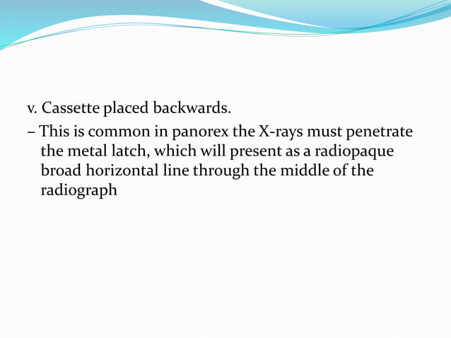 Common errors in opg | PPTX | Dental Health | Diseases and Conditions