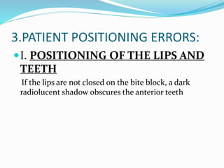 Common errors in opg | PPTX