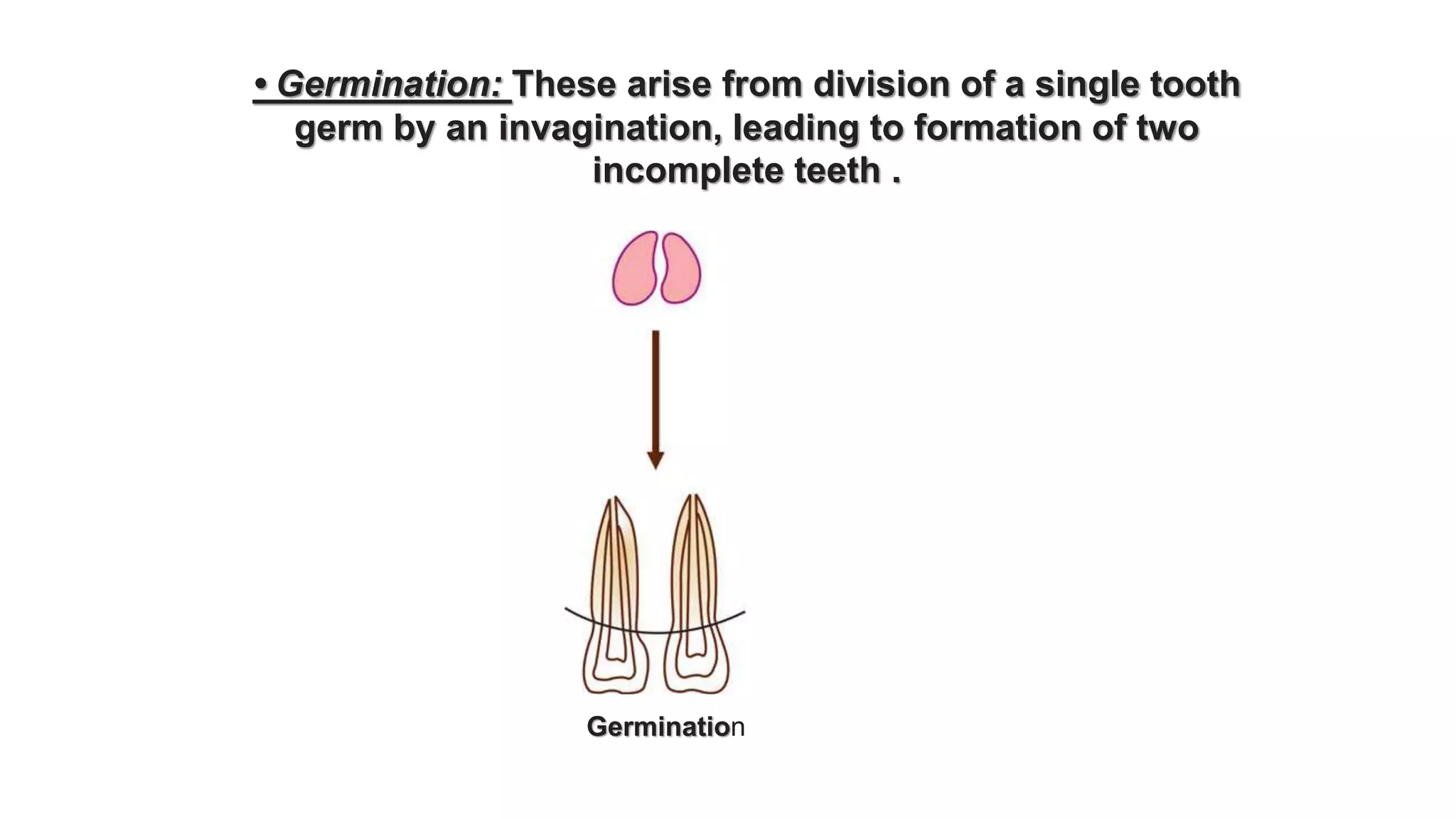 Common etiological factors of malocclusion | PPTX