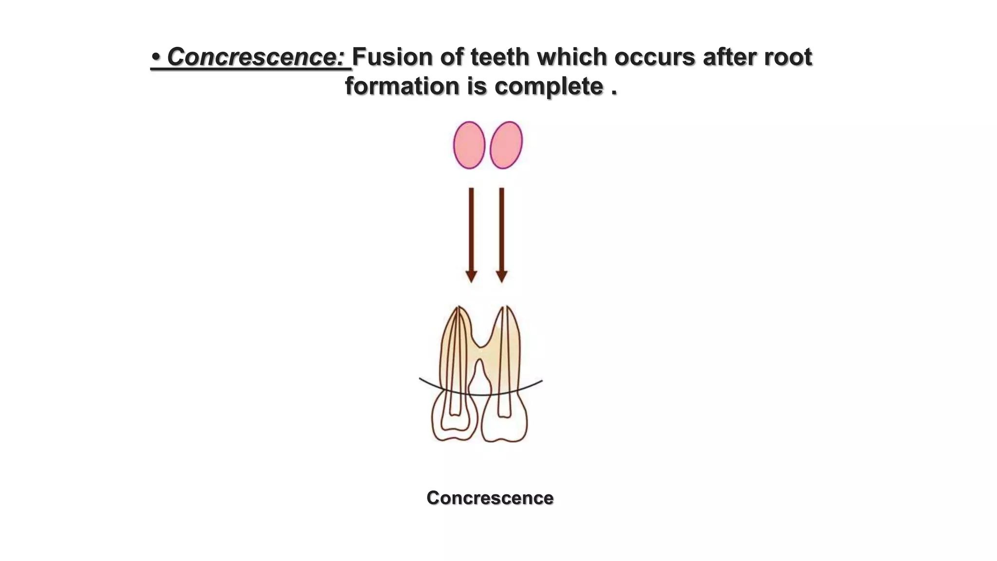 Common etiological factors of malocclusion | PPTX