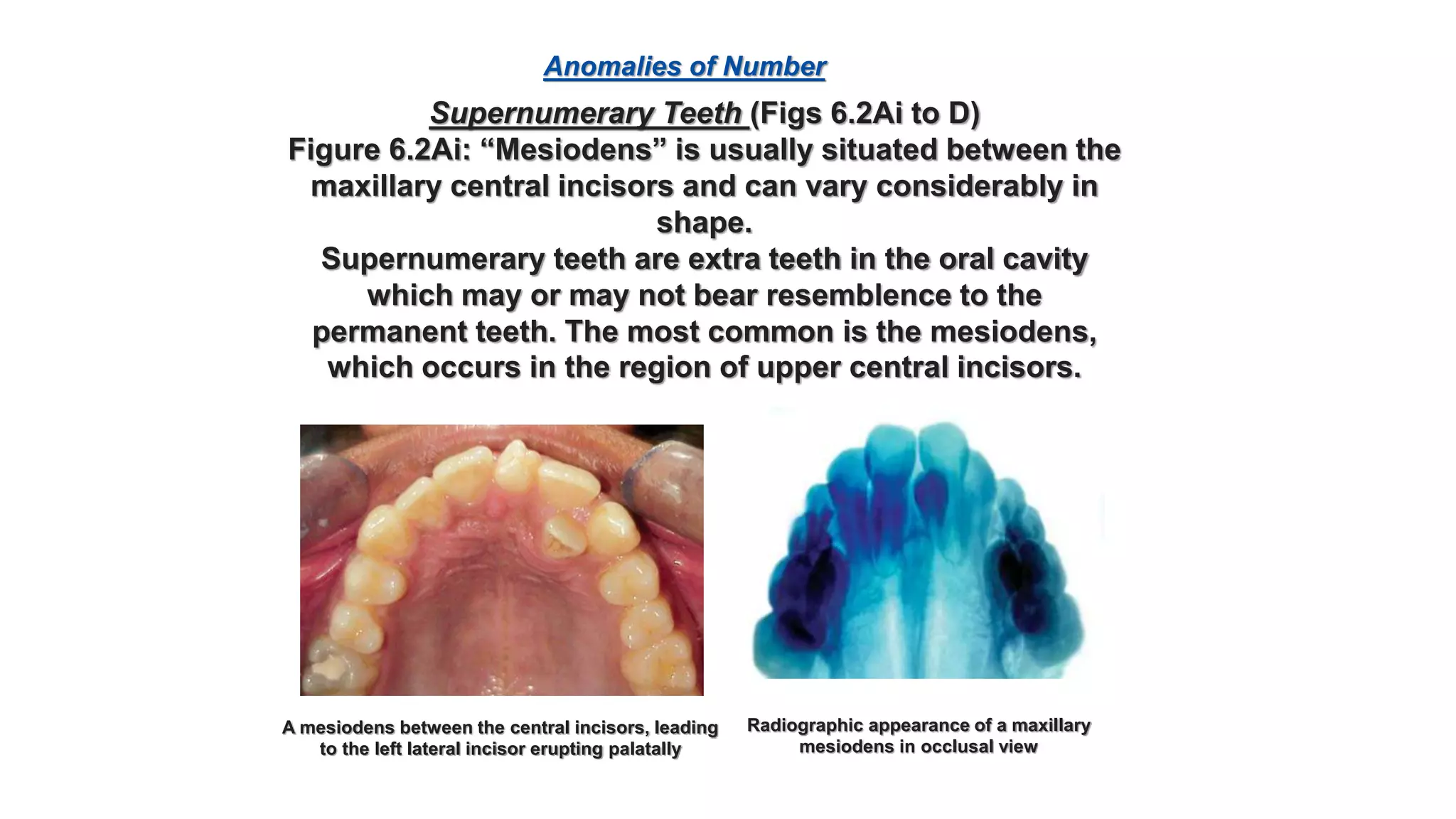 Common etiological factors of malocclusion | PPTX
