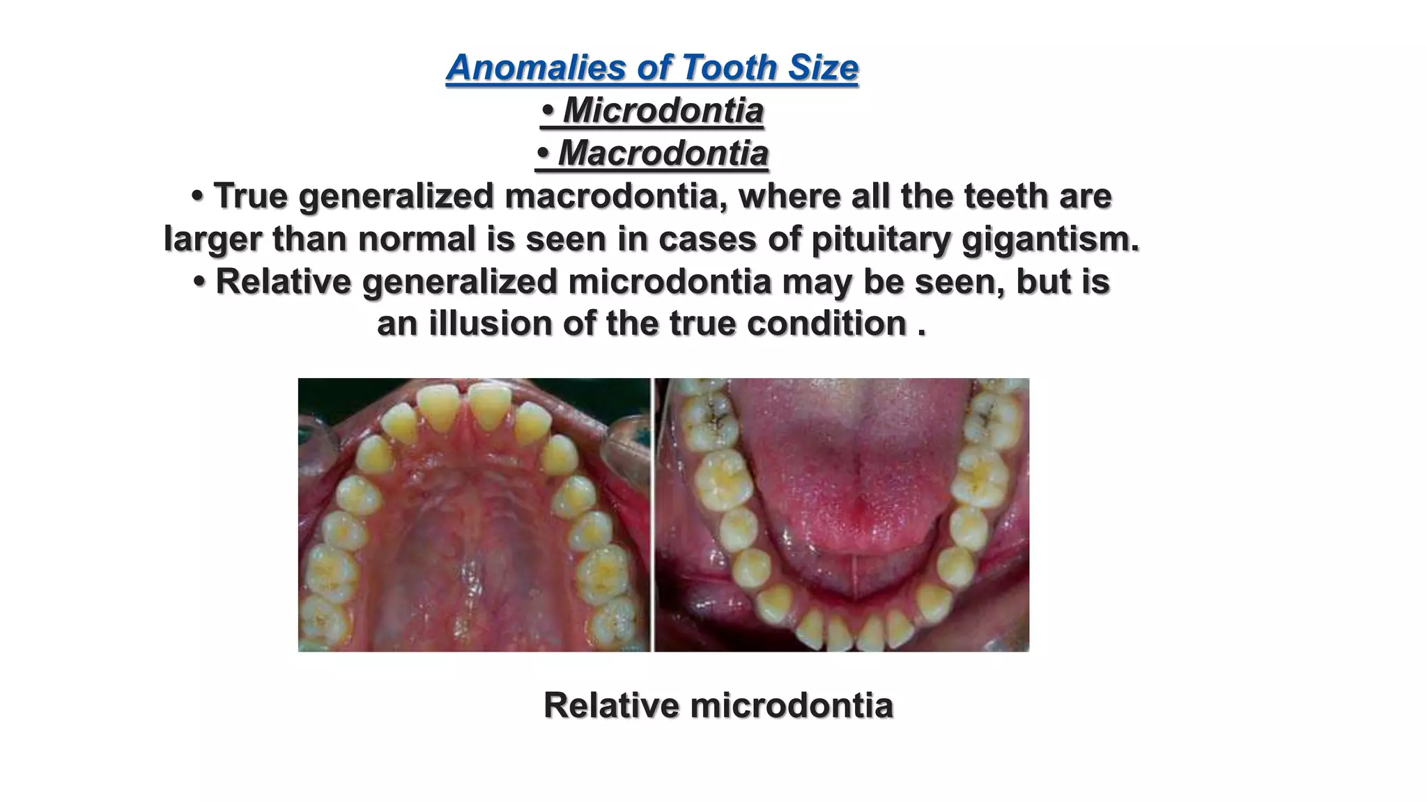 Common etiological factors of malocclusion | PPTX