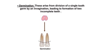Common etiological factors of malocclusion | PPTX