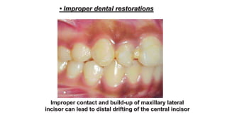 Common etiological factors of malocclusion | PPTX