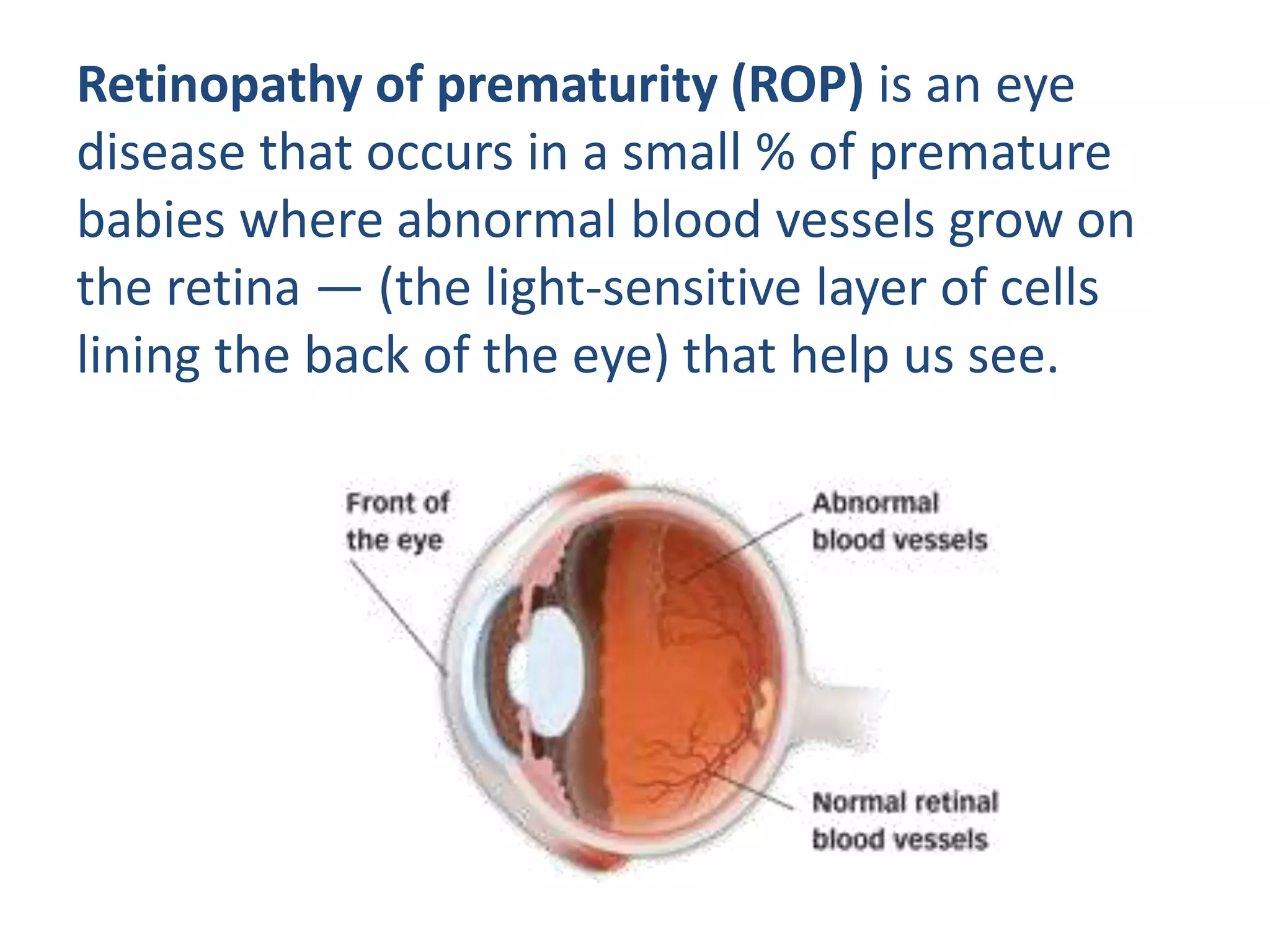 Common eye disease | PPTX