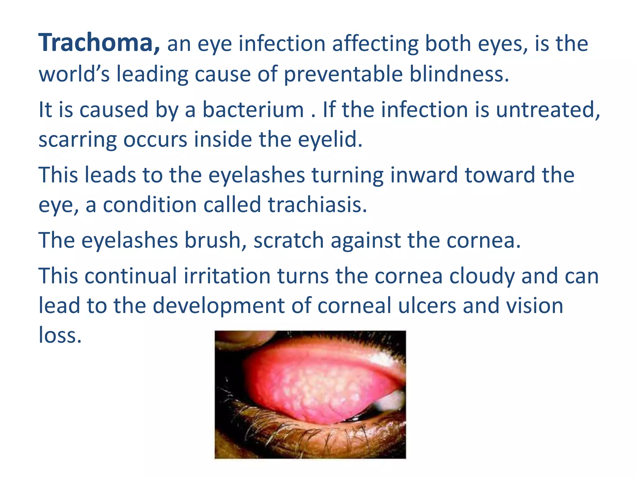 Common eye disease | PPTX