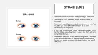 Common eye disease | PPTX