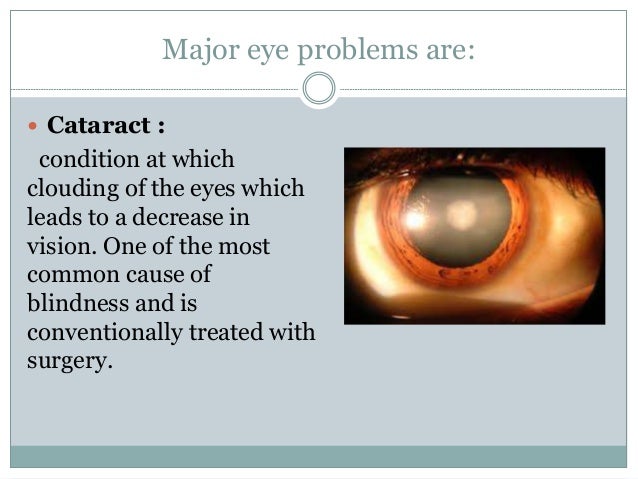 Common eye diseases