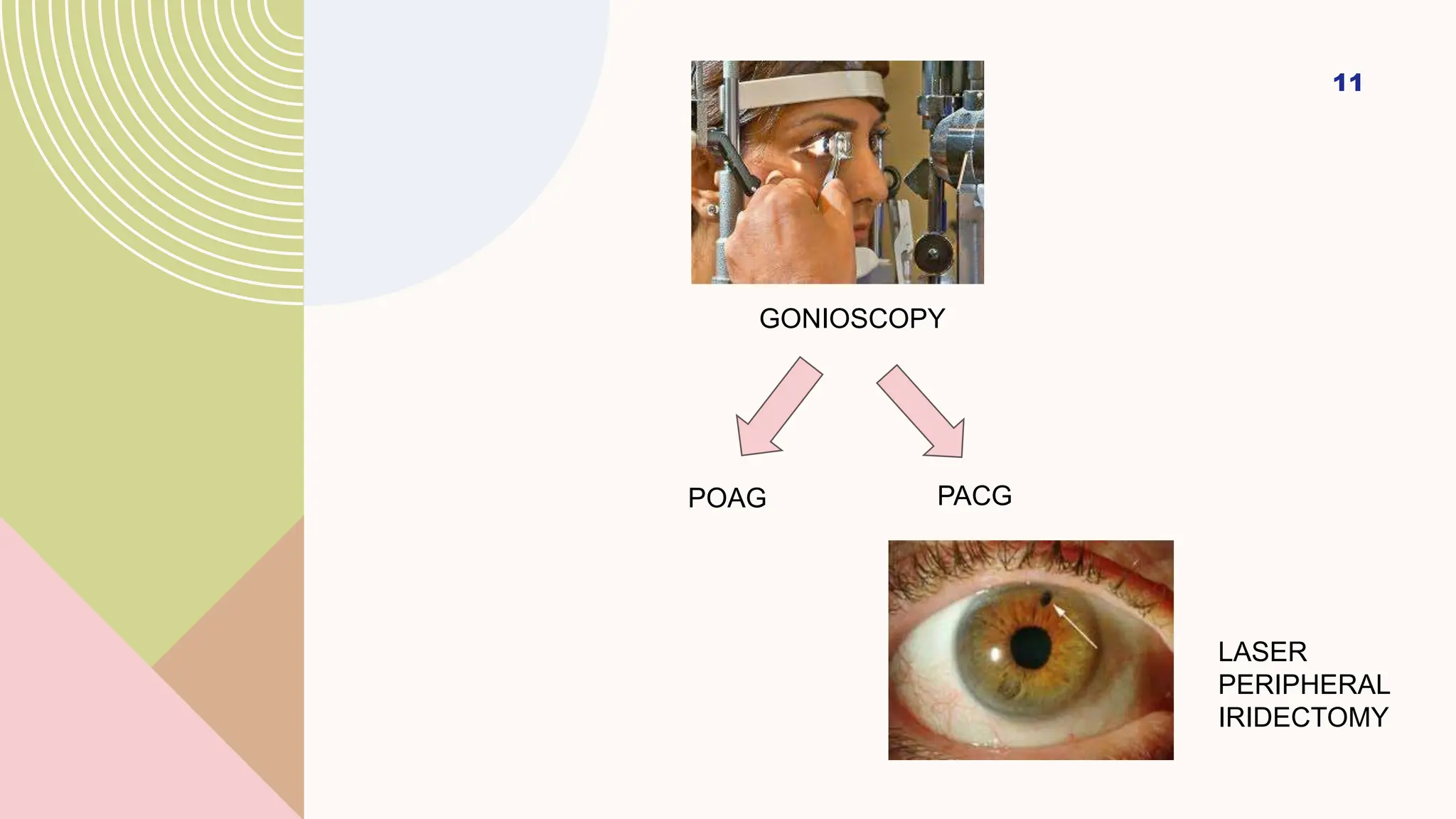 Common eyediseases you need to know.pptx